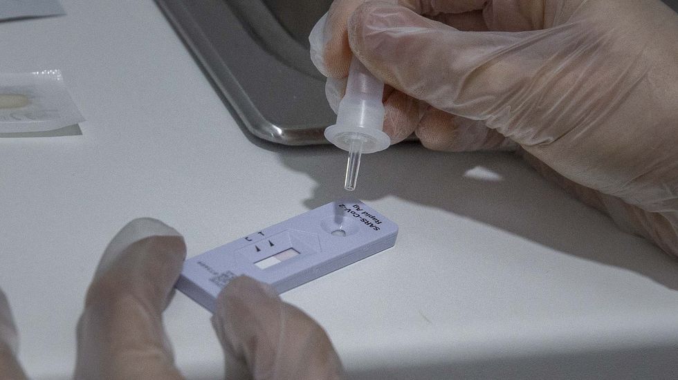 El test de antígenos: ¿cómo y cuando hacerlo?